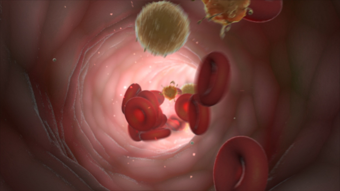 Expanding the Reach of Medical Animation CG